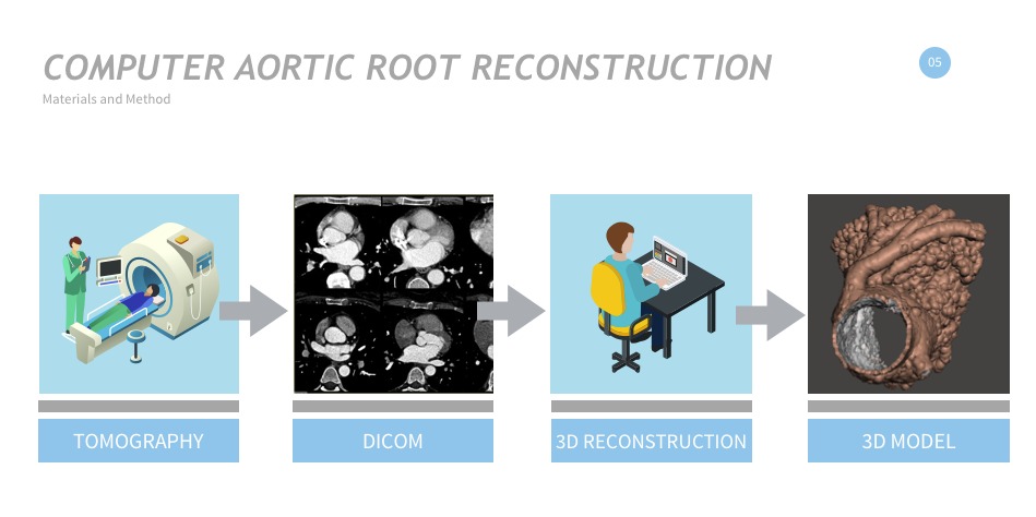 Surgeons bring 3D printed preoperative models to Argentine Children's ...