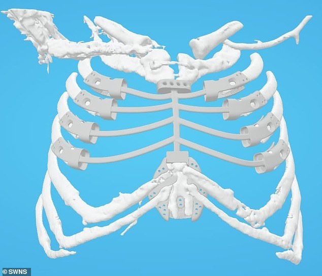 British patient becomes the sixth person in the world to be equipped ...